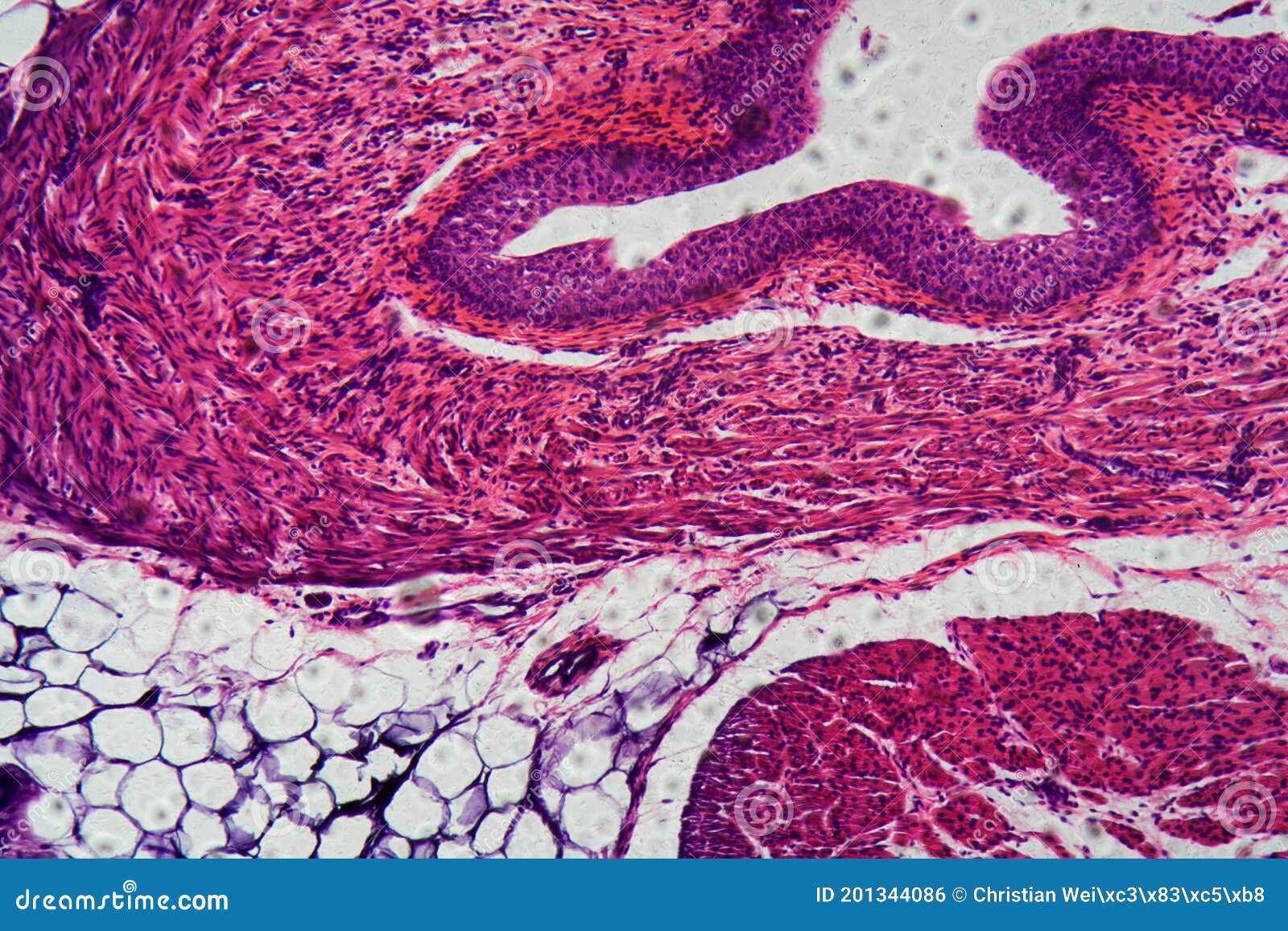 Human Transitional Epithelium Under the Microscope Stock Photo - Image ...