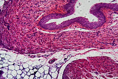 Human Transitional Epithelium Under the Microscope Stock Photo - Image ...