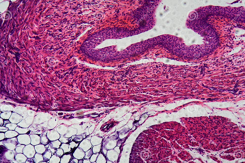 Human Transitional Epithelium Under the Microscope Stock Photo - Image ...