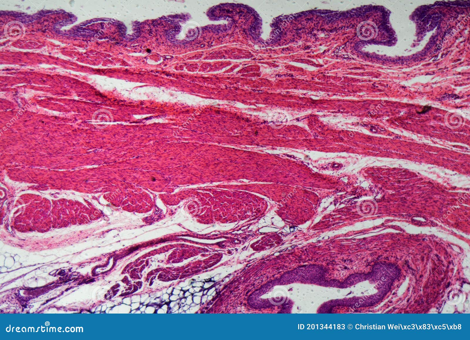 Human Transitional Epithelium Under the Microscope Stock Image - Image ...