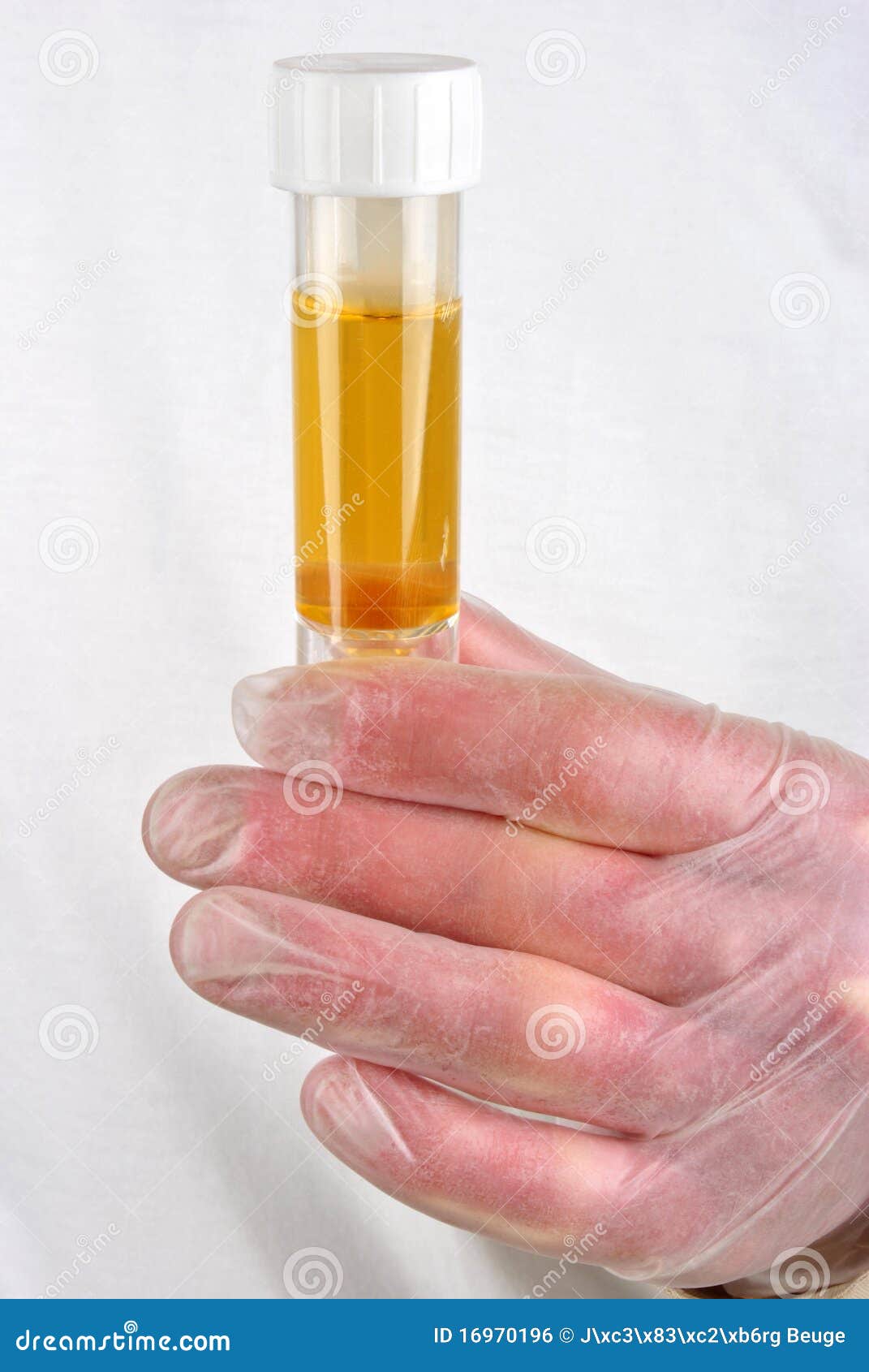 Human Urine in a Sample Bottle Stock Photo - Image of freshly, hand ...