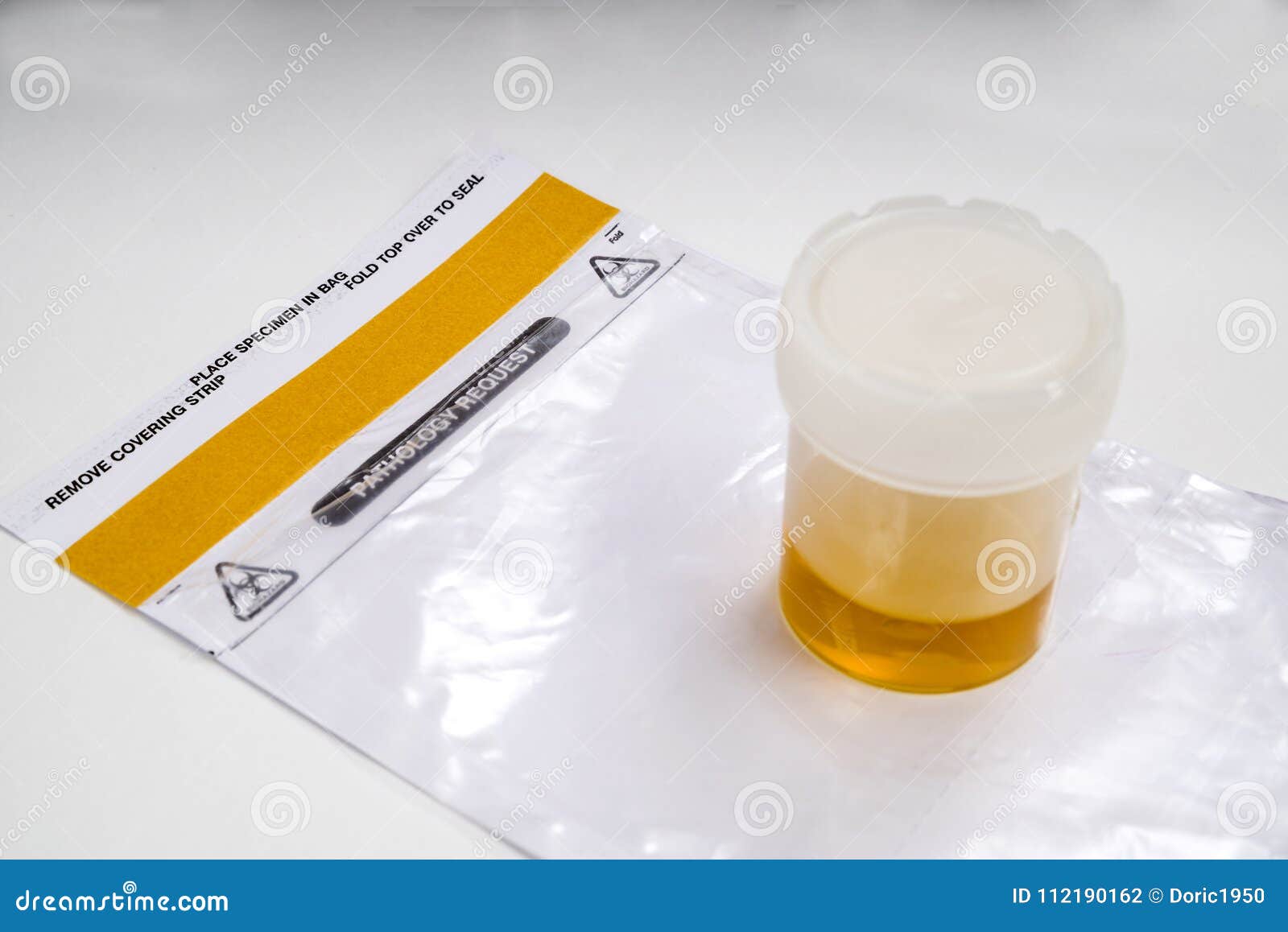 Human Urine Sample. stock photo. Image of feces, substance - 112190162