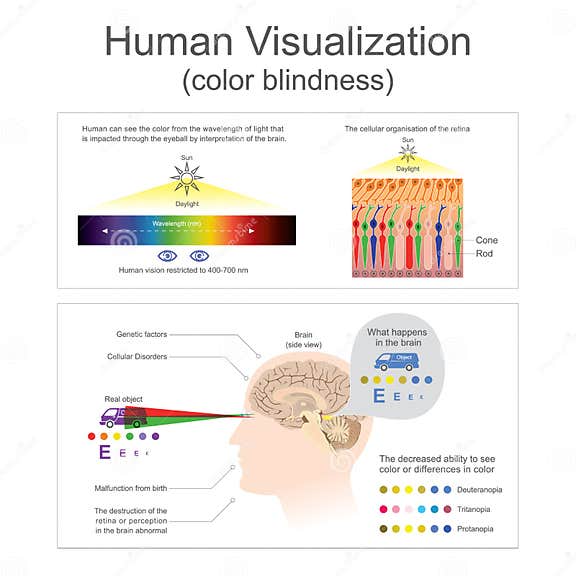 Human Visualization Color Blindness. Stock Vector - Illustration of ...