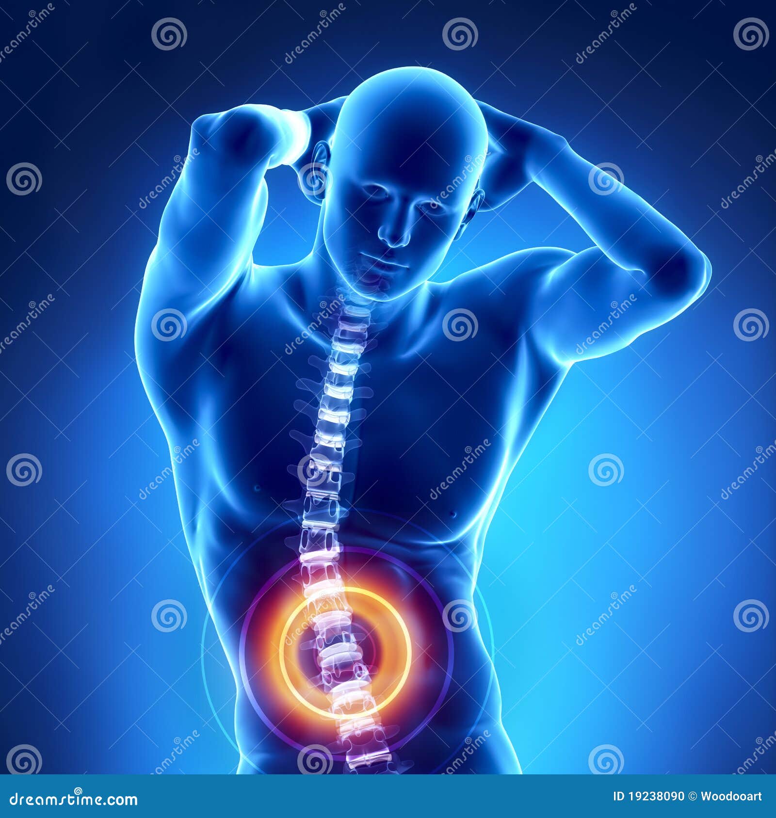 Spine Problem. Joints Diseases Pain. Arthritis, Osteoarthritis Symptoms ...