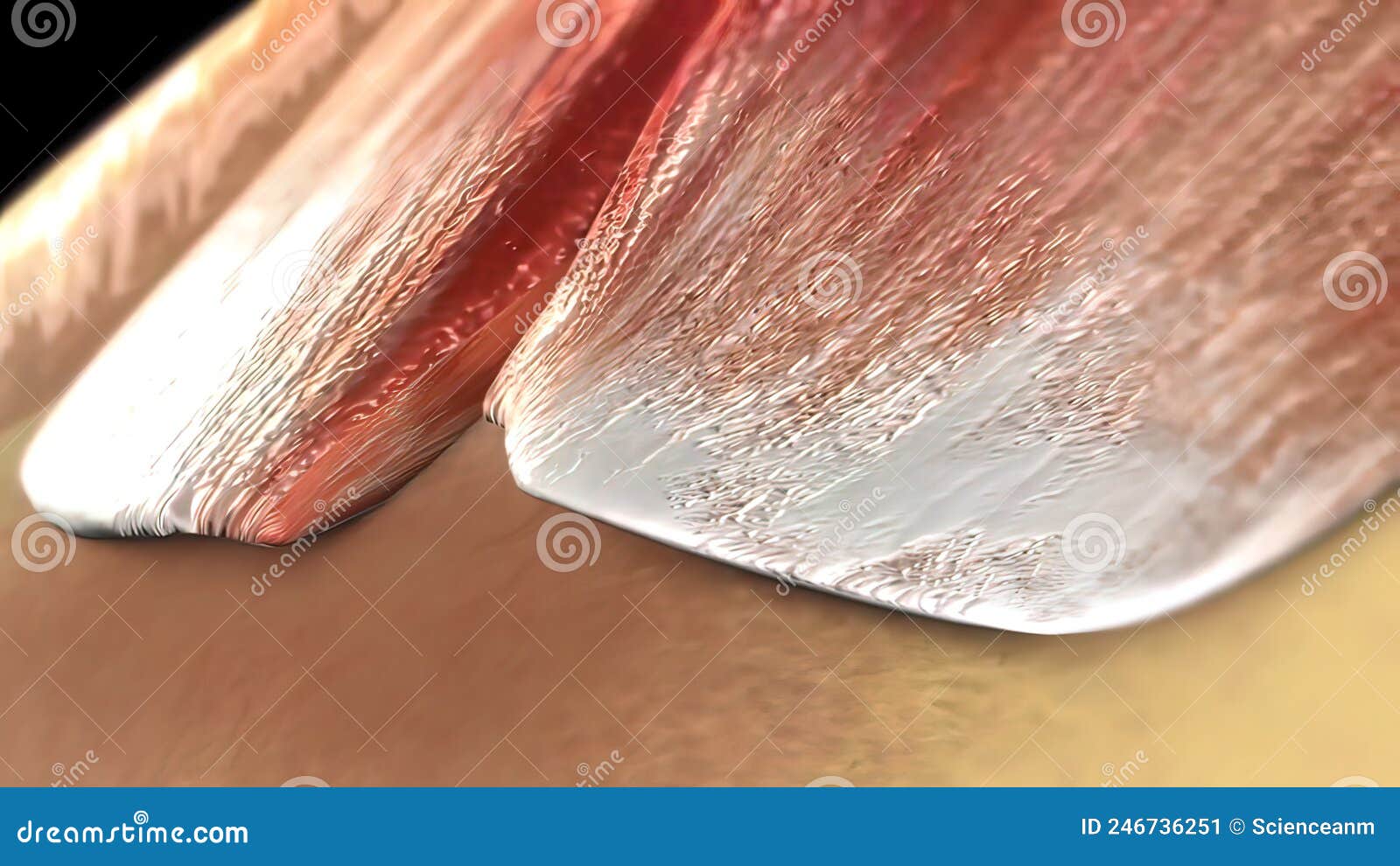 The Humeral Head is the Articular Surface of the Upper Extremity, Which ...