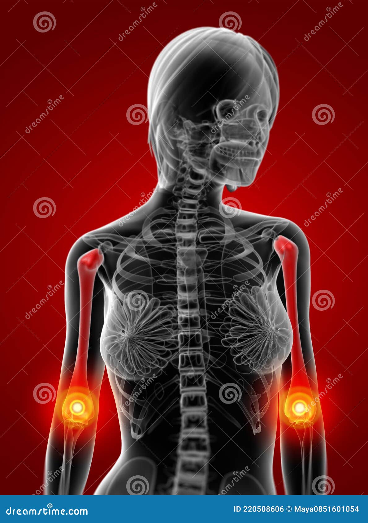 Highlighted Humerus Bone Royalty-Free Illustration | CartoonDealer.com ...