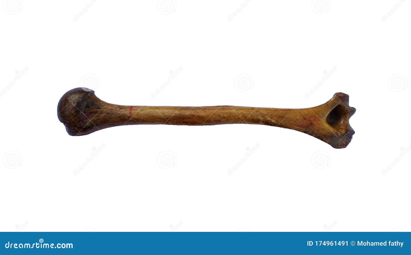 Human Humerus Bone