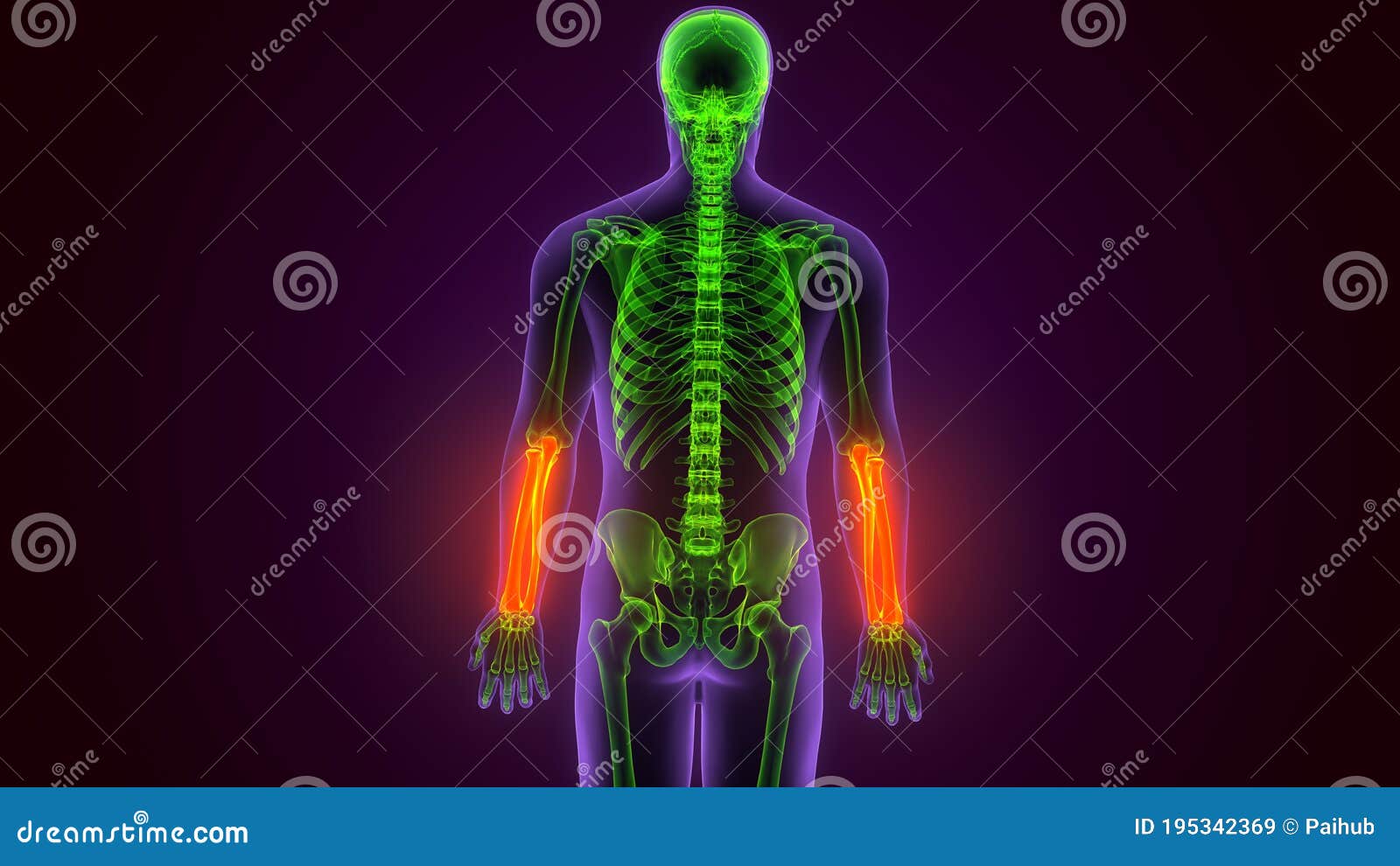 Radius And Ulna Bone Anatomy With Arm Skeletal Structure Outline ...