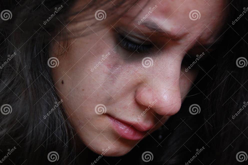 Hurt stock image. Image of sadness, hurting, caucasian - 15384409