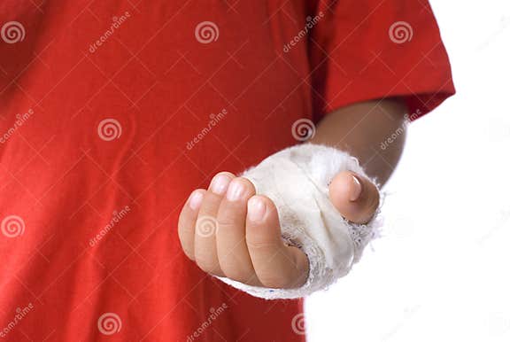 Hurt Hand stock image. Image of healing, break, injured - 8047939