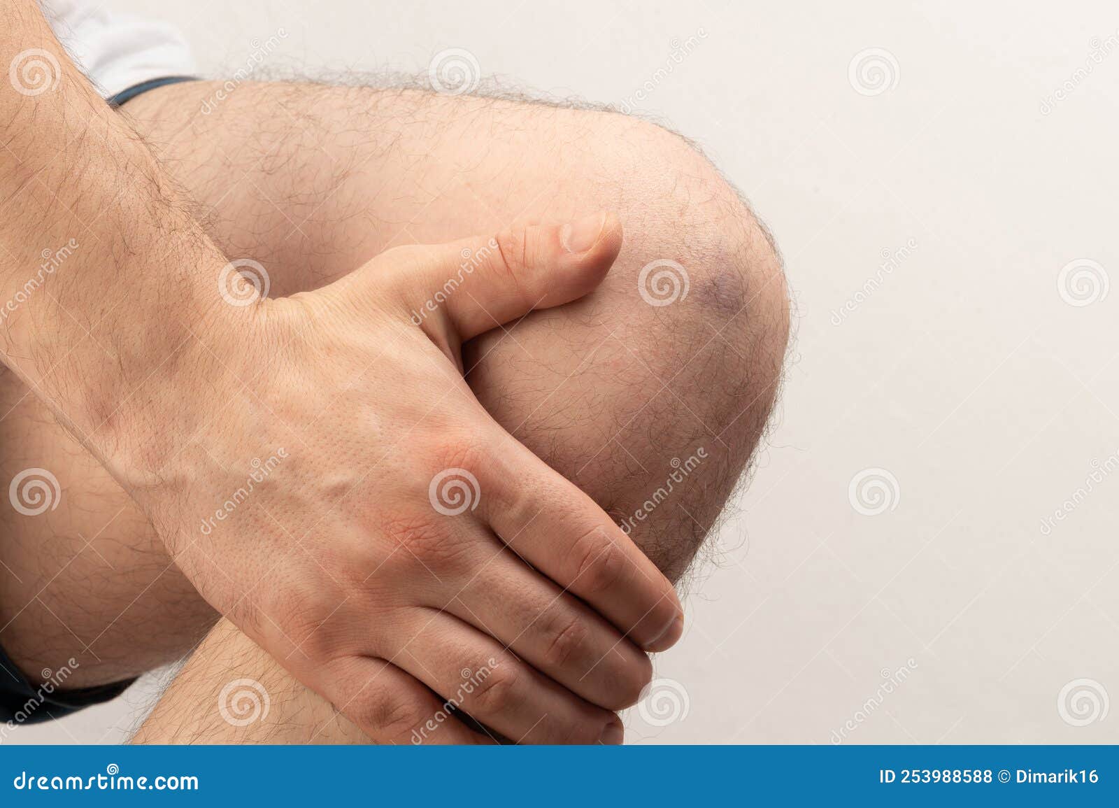 Hurt knee theme stock photo. Image of fall, swelling - 253988588