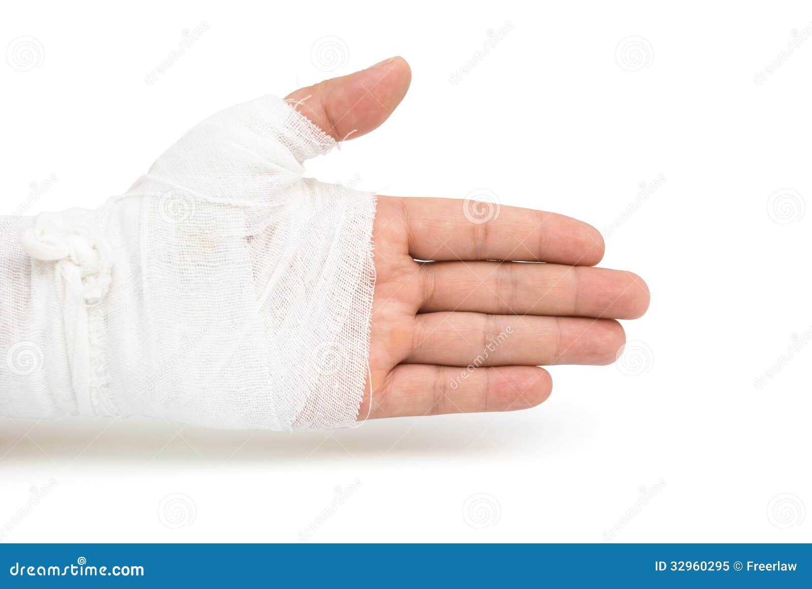 Hurted hand stock image. Image of laborfinancial, reimburse - 32960295