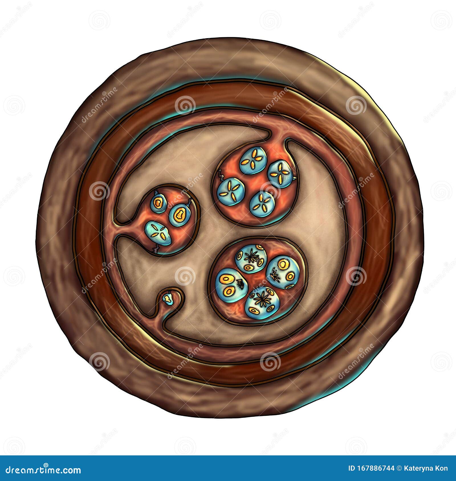 Hydatid Cyst of Echinococcus Granulosus Stock Photo - Image of cystic ...