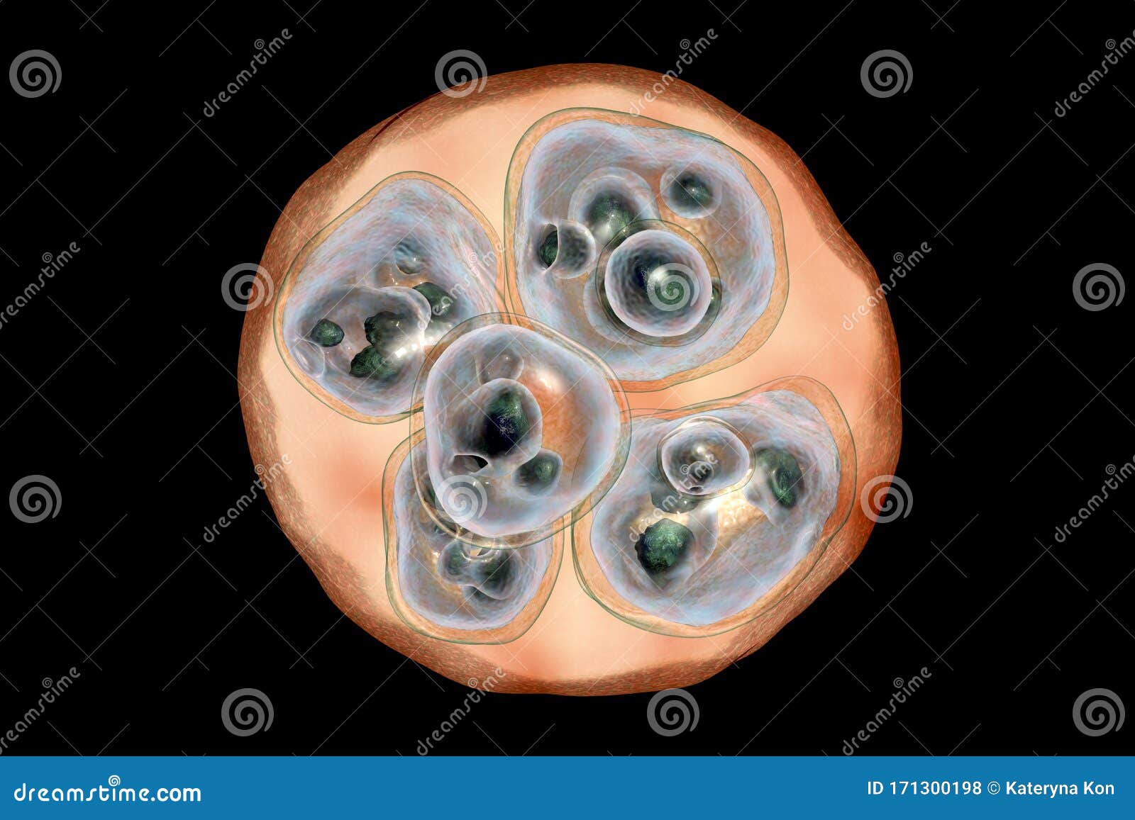 Hydatid Cyst of Echinococcus Multilocularis Stock Illustration ...