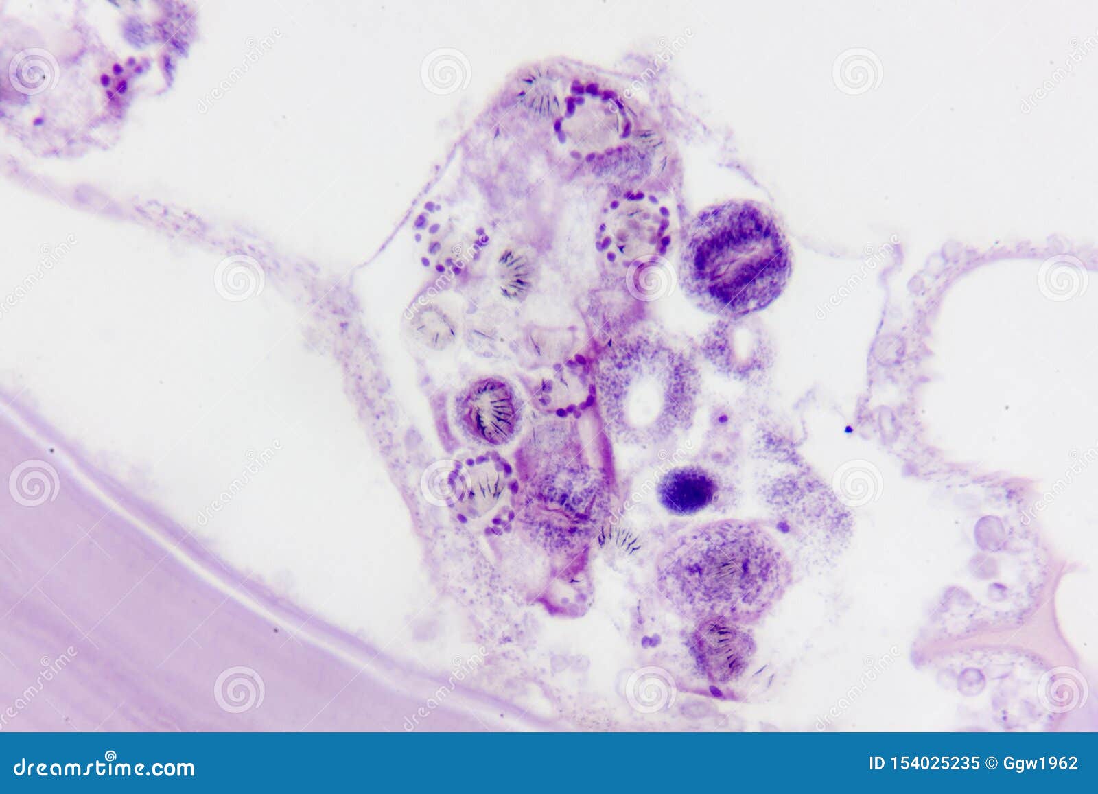 Hydatid Cyst Under The Microscope 100x. Echinococcus Granulosus. Dog ...