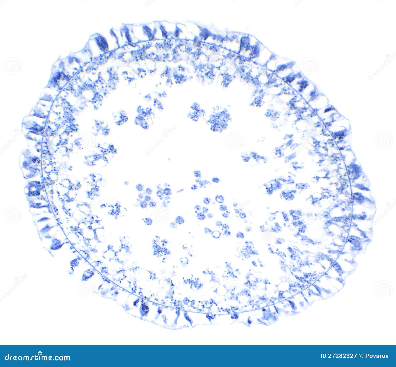 Hydra under the microscope stock image. Image of cells - 27282327