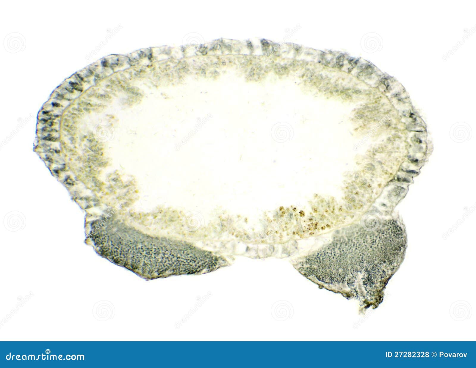 Hydra Cross Section Under Microscope