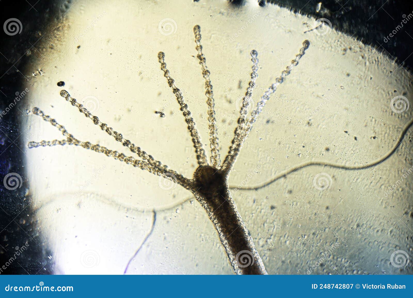 Hydra Vulgaris Under The Microscope. Fresh-water Polyp Royalty-Free ...