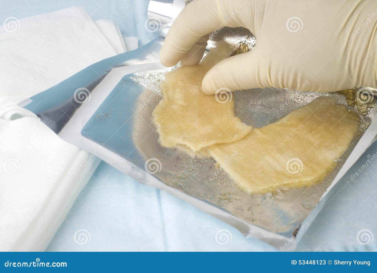 Hydrogel Burn Dressing stock image. Image of fire, medical - 53448123