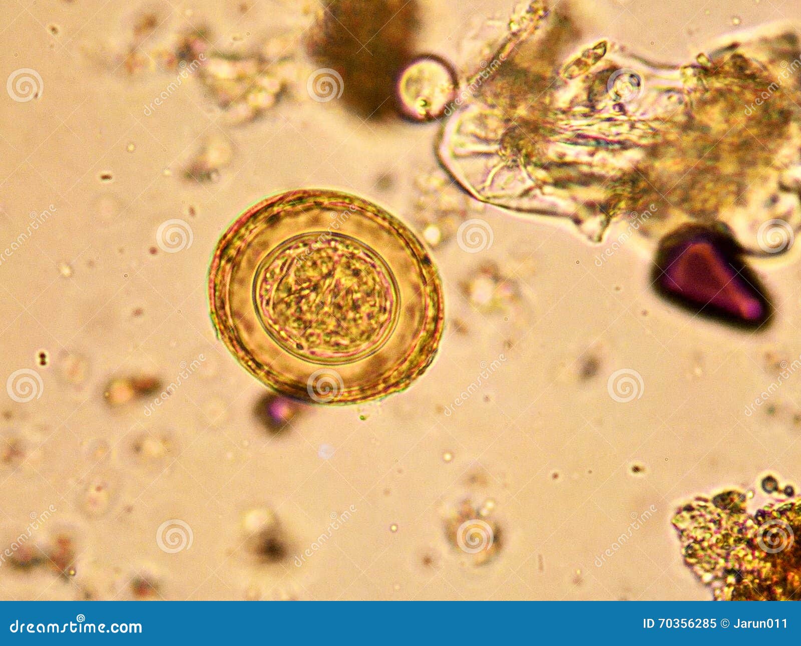 Hymenolepis diminuta stock image. Image of microscope - 70356285