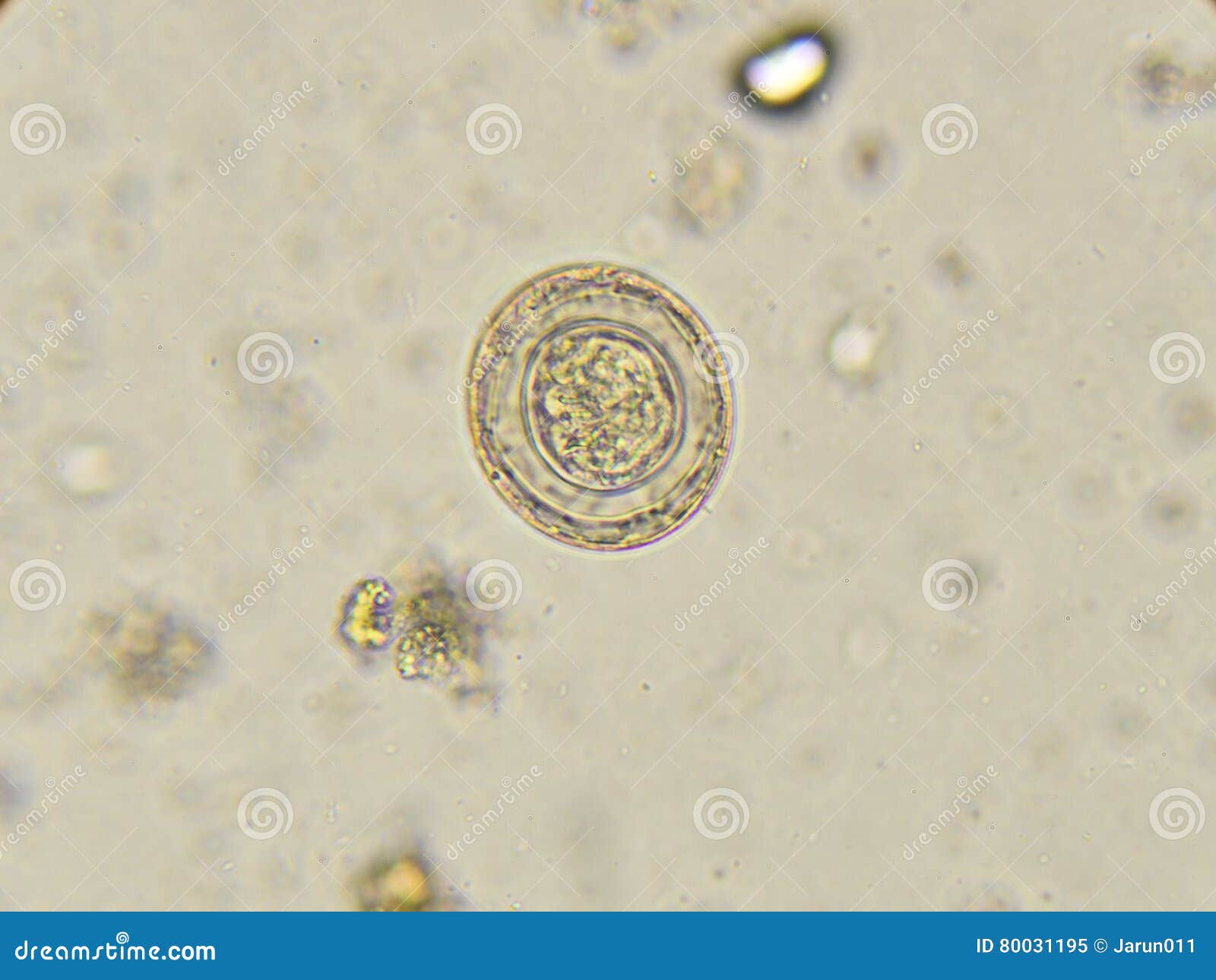 Hymenolepis Diminuta Egg