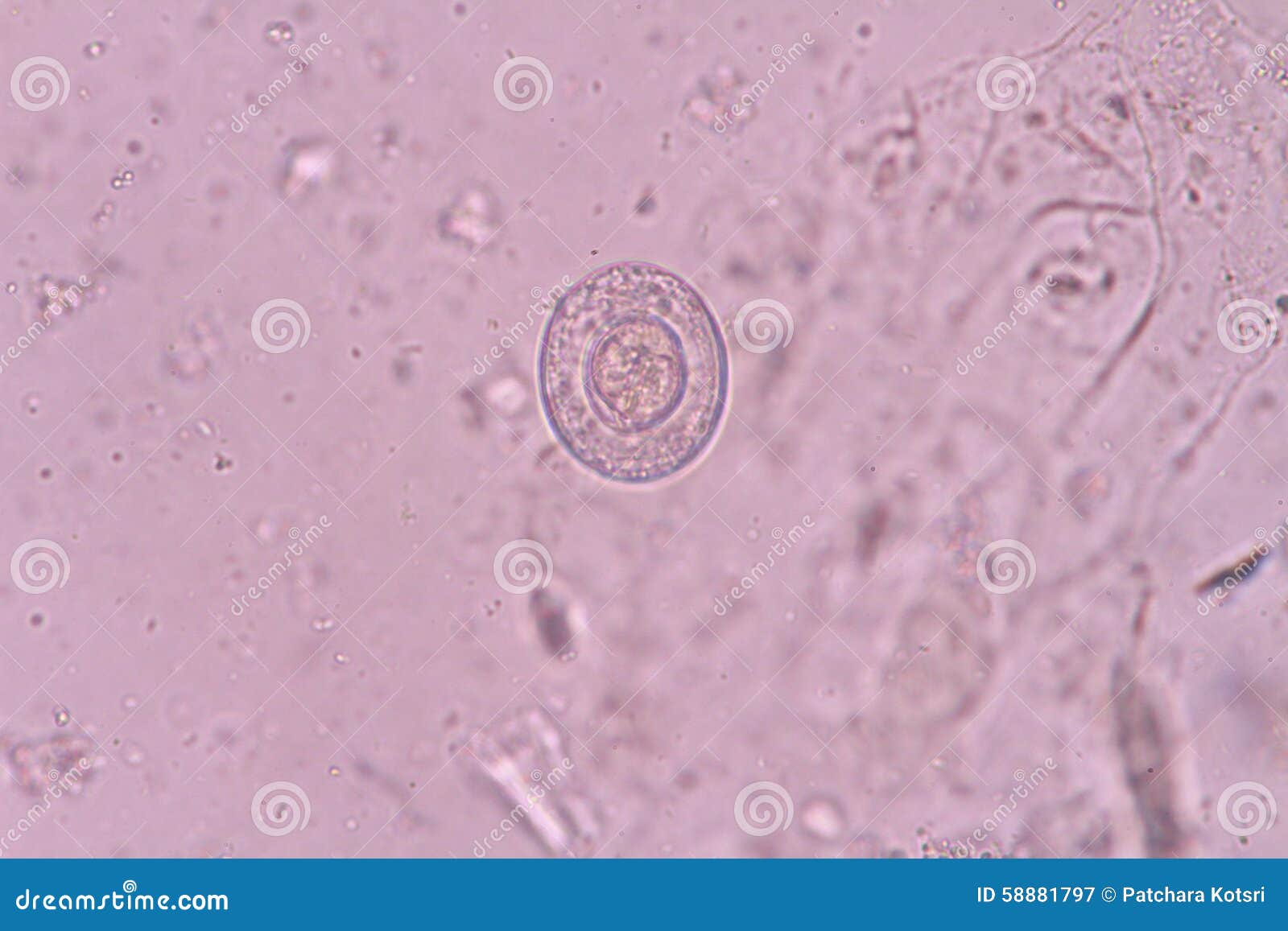 Hymenolepis stock image. Image of labolatory, microscopic - 58881797