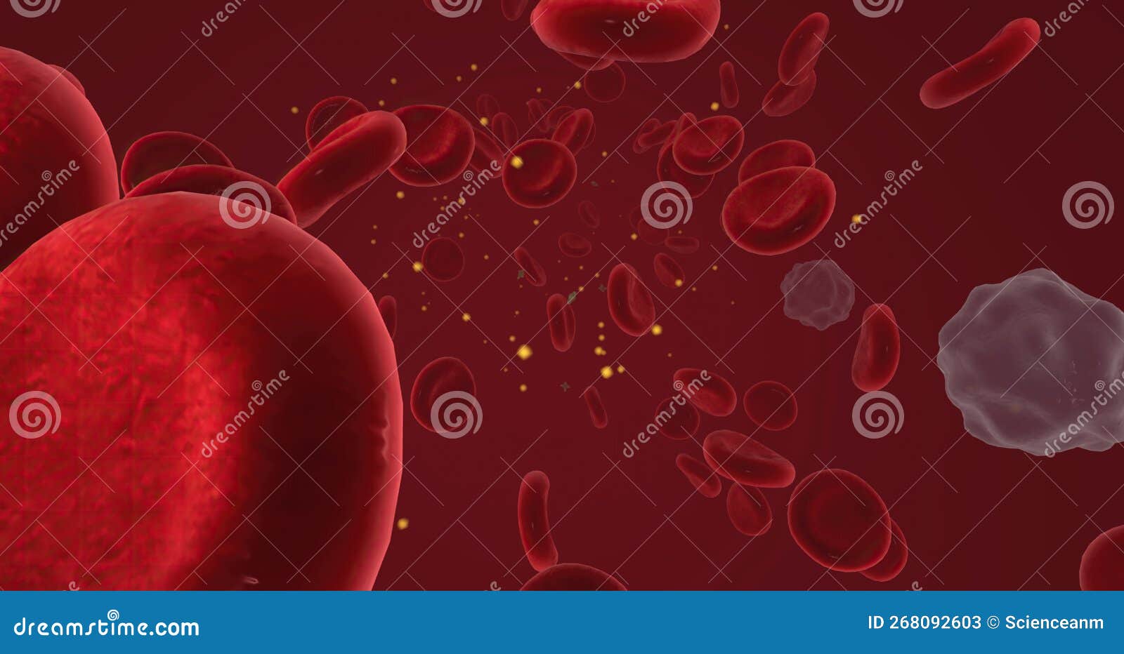 Hypercalcemia is a Condition Characterized by Increased Calcium Levels ...