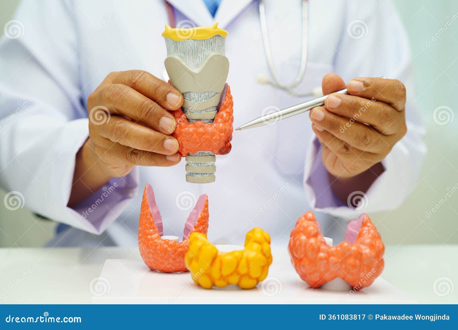 Hyperthyroidism, Overactive Thyroid, Thyroid Lymphoma, Asian Doctor ...
