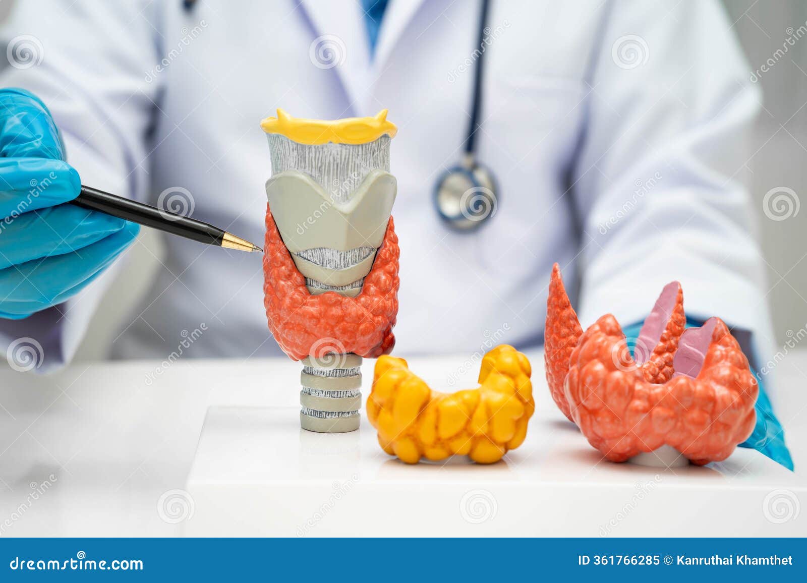 Hyperthyroidism, Overactive Thyroid, Thyroid Lymphoma, Asian Doctor ...