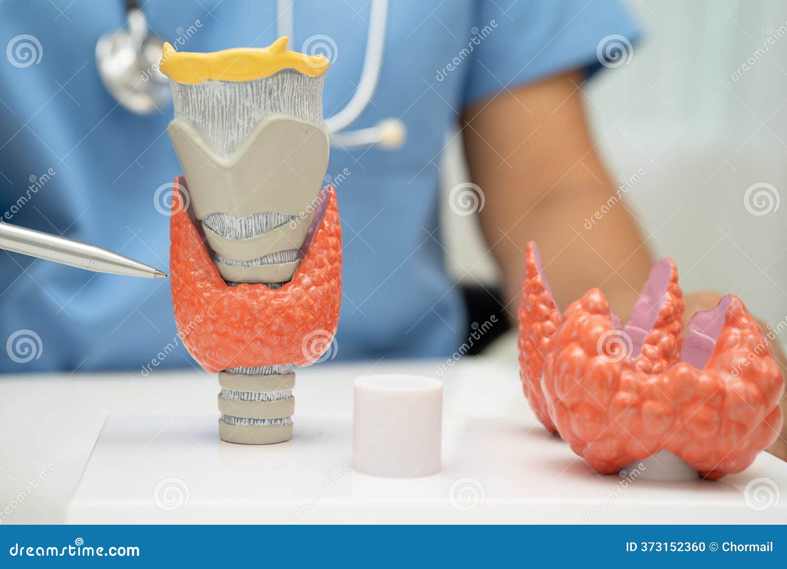 Hyperthyroidism, Overactive Thyroid, Thyroid Lymphoma, Asian Doctor ...