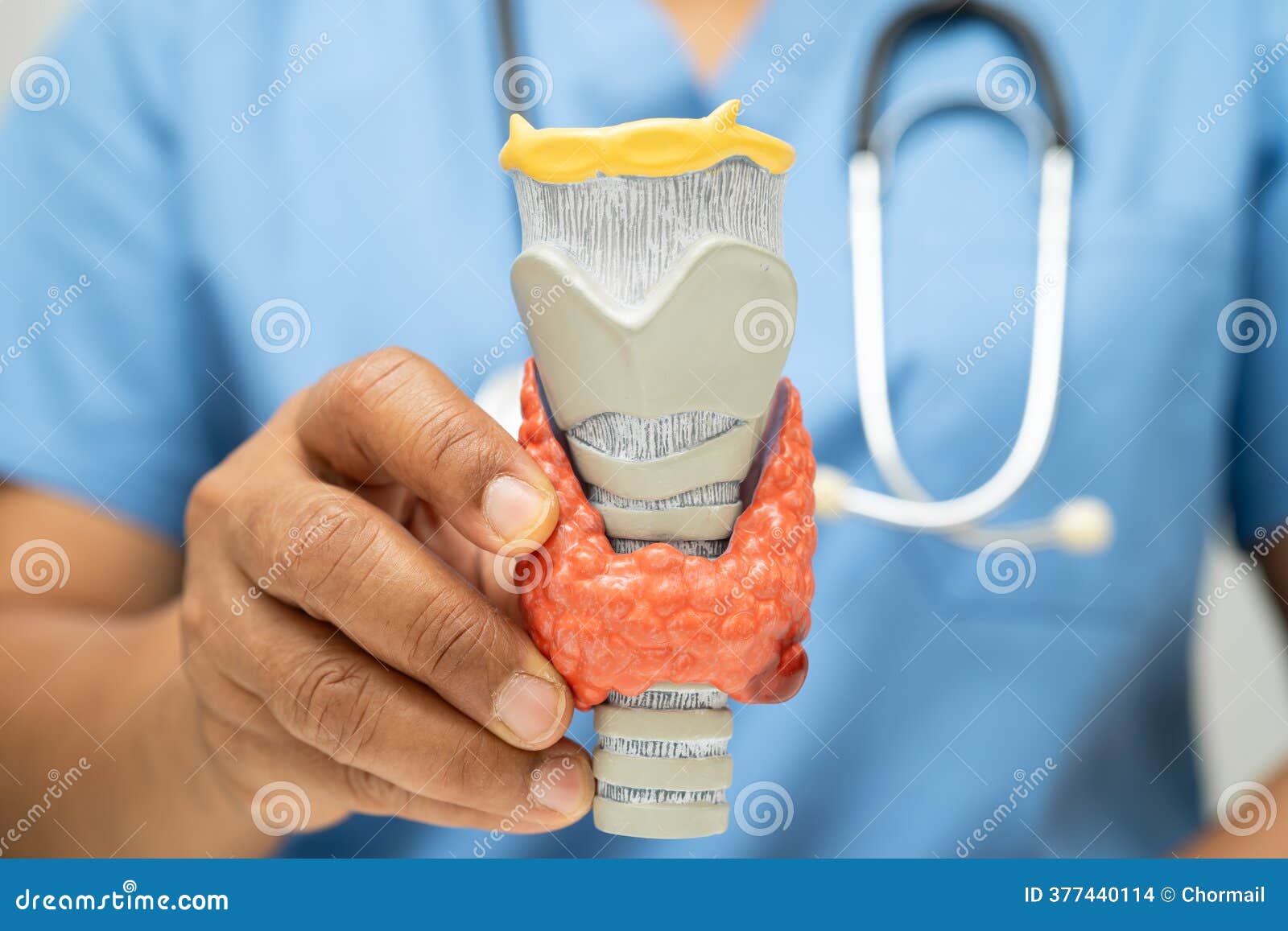 Hyperthyroidism, Overactive Thyroid, Thyroid Lymphoma, Asian Doctor ...