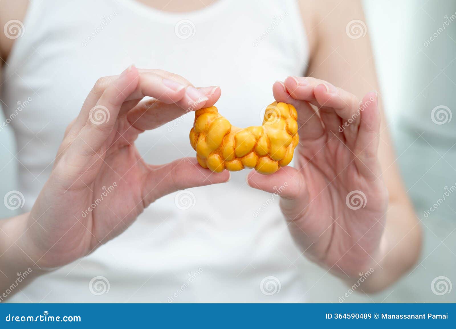 Hyperthyroidism, Overactive Thyroid, Thyroid Lymphoma, Asian Doctor ...