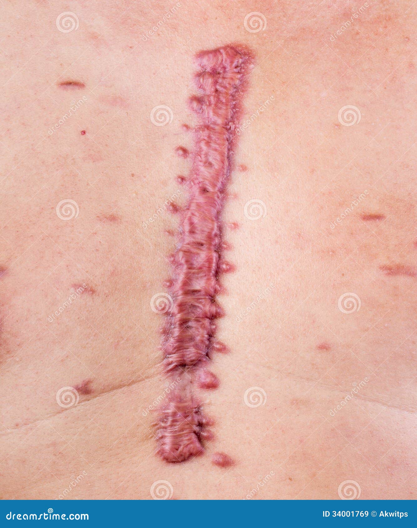 475 Pink Scar Stock Photos - Free & Royalty-Free Stock Photos from ...