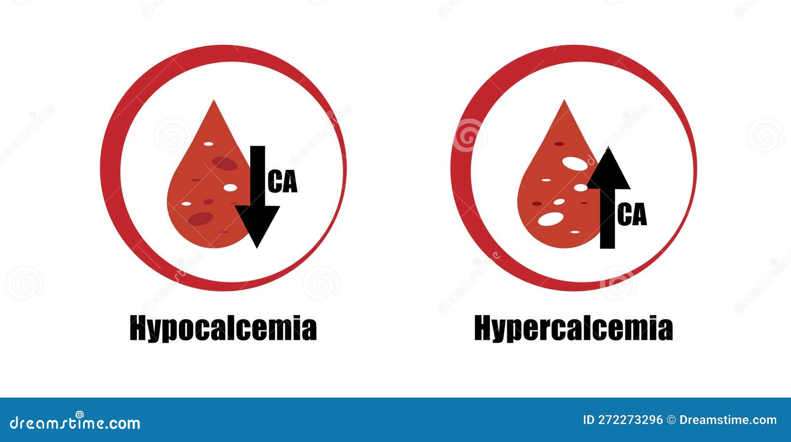 Hypocalcemia and Hypercalcemia Vector. Round Iicon Stock Vector ...