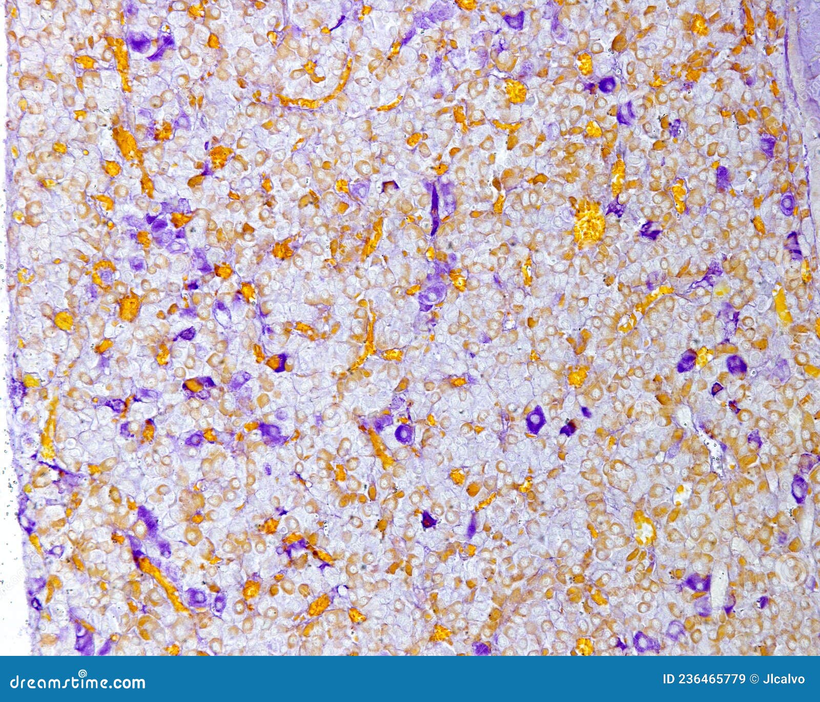 Hypophysis. Anterior Lobe. Gabe`s Method Stock Image - Image of gland ...