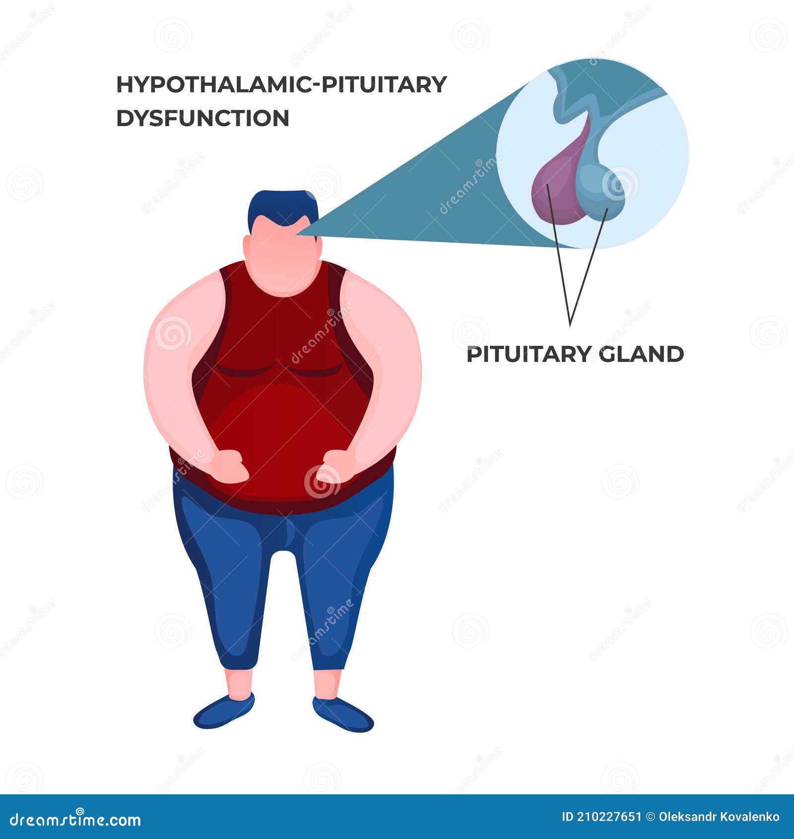 Hypothalamic Dysfunction