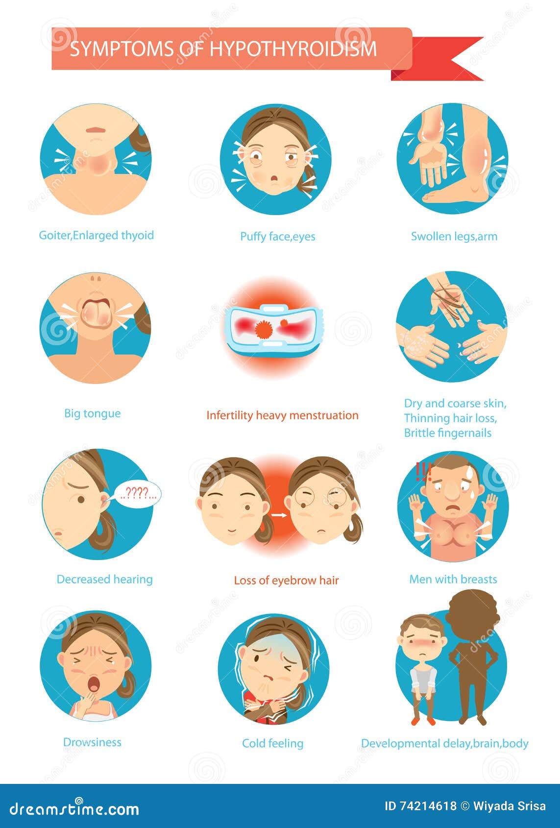 Hypothyroidism Cartoons, Illustrations & Vector Stock Images - 2400 ...
