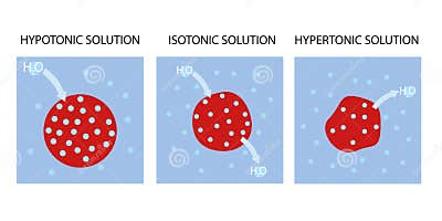 Hypotonic, Isotonic and Hypertonic Solutions Vector. Tonicity and ...