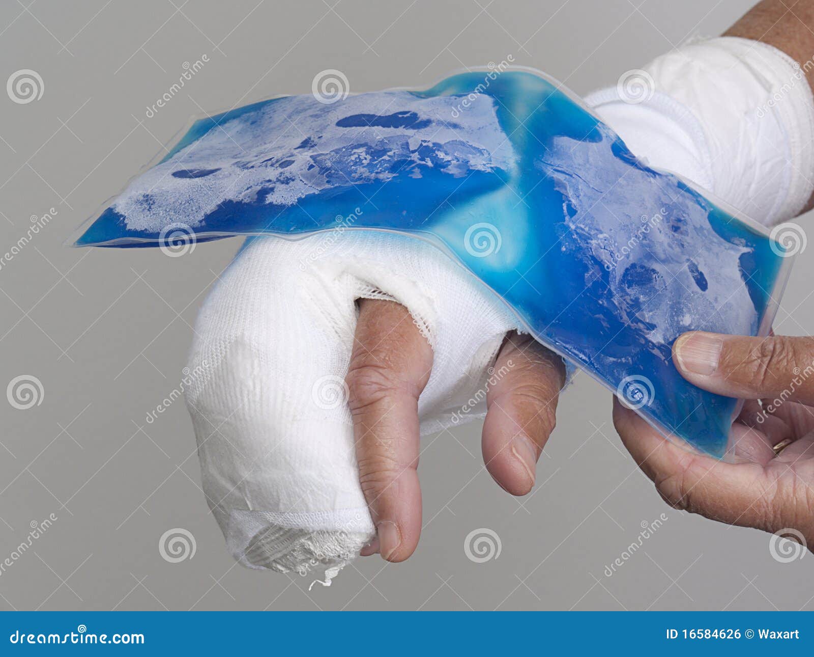 Icepack Placed on Bandaged Hand Stock Photo - Image of photograph, gray ...