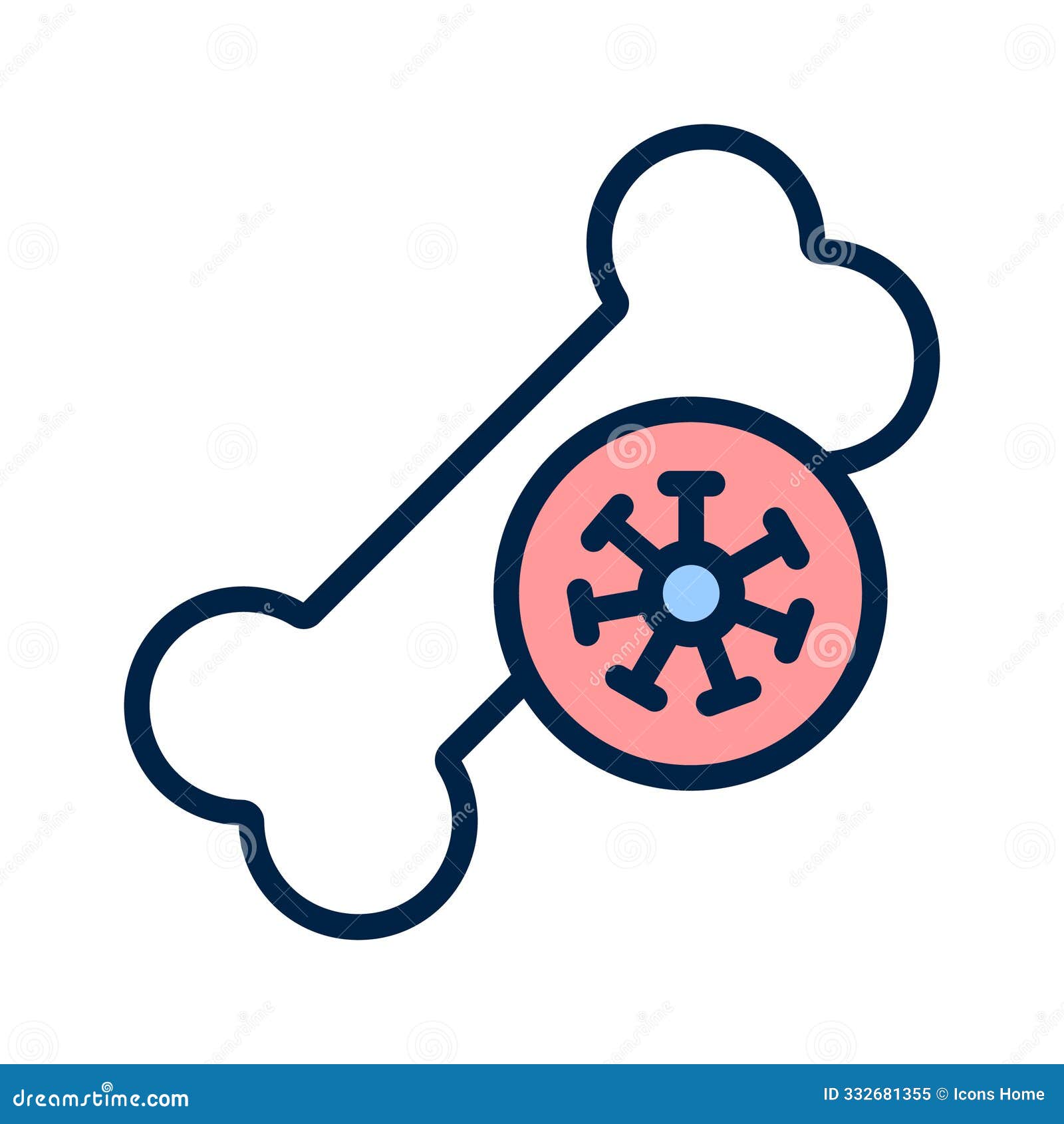 Infected Bone stock illustration. Illustration of bacteria - 332681355