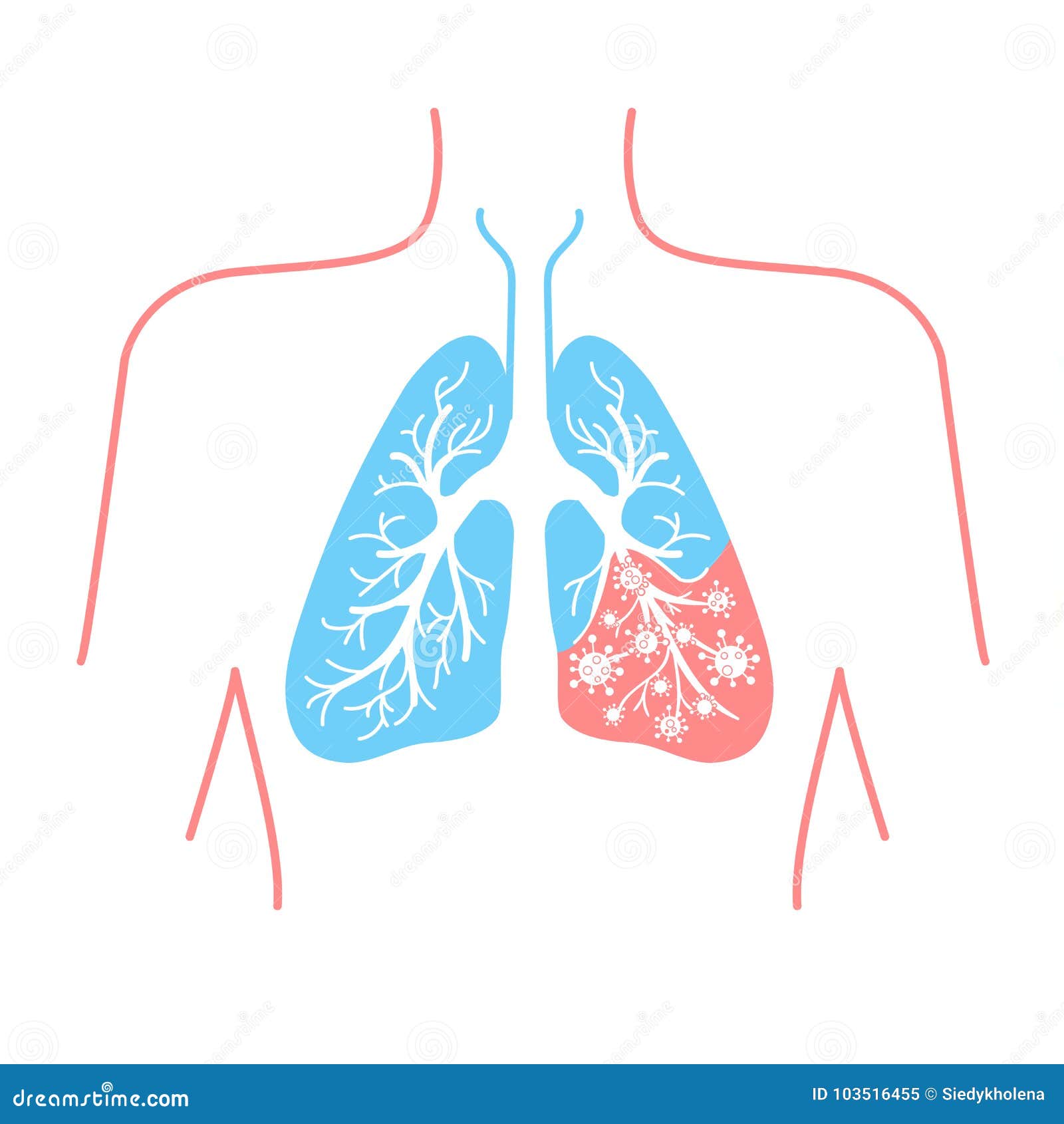 Icon Of Lung Disease Pneumonia Stock Illustration Illustration Of