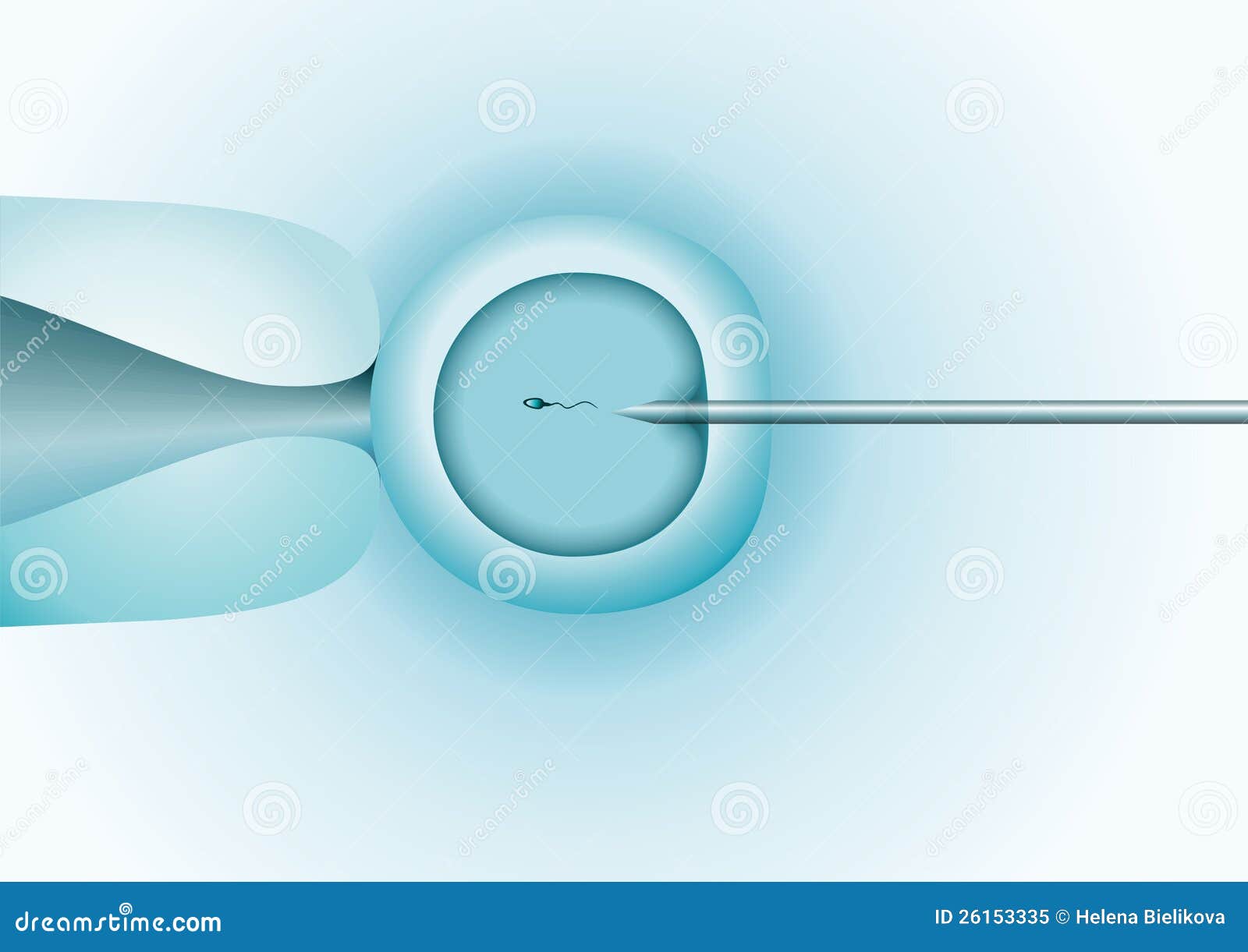 ICSI - stage 3 stock illustration. Illustration of genetic - 26153335