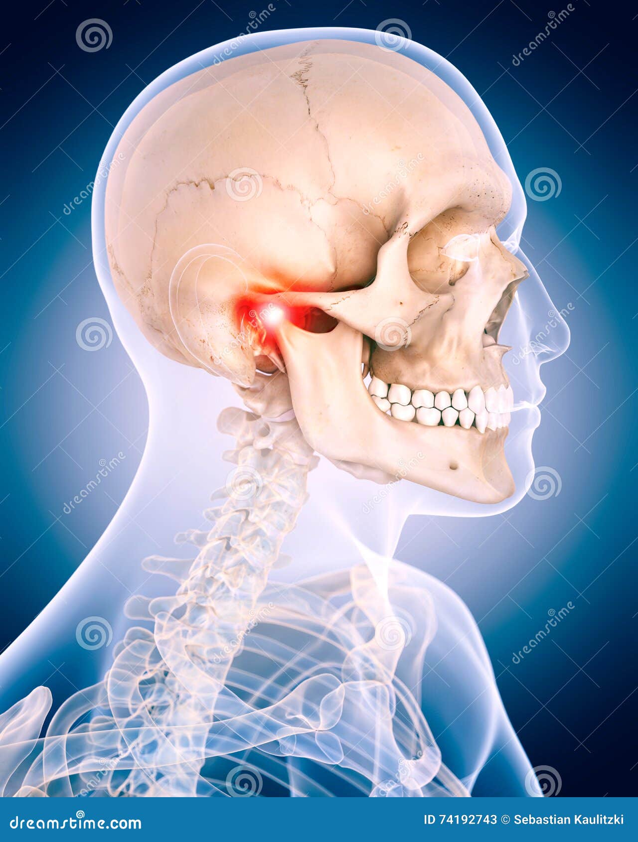 Il collo doloroso illustrazione di stock. Illustrazione di anatomia ...