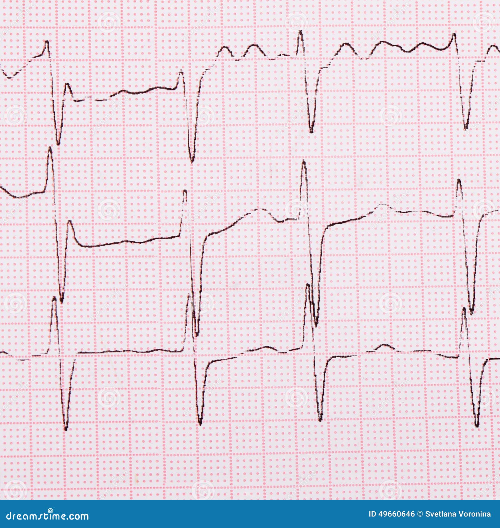 Il Nastro Con Il Cardiogramma Di Un Uomo Fotografia Stock - Immagine di ...