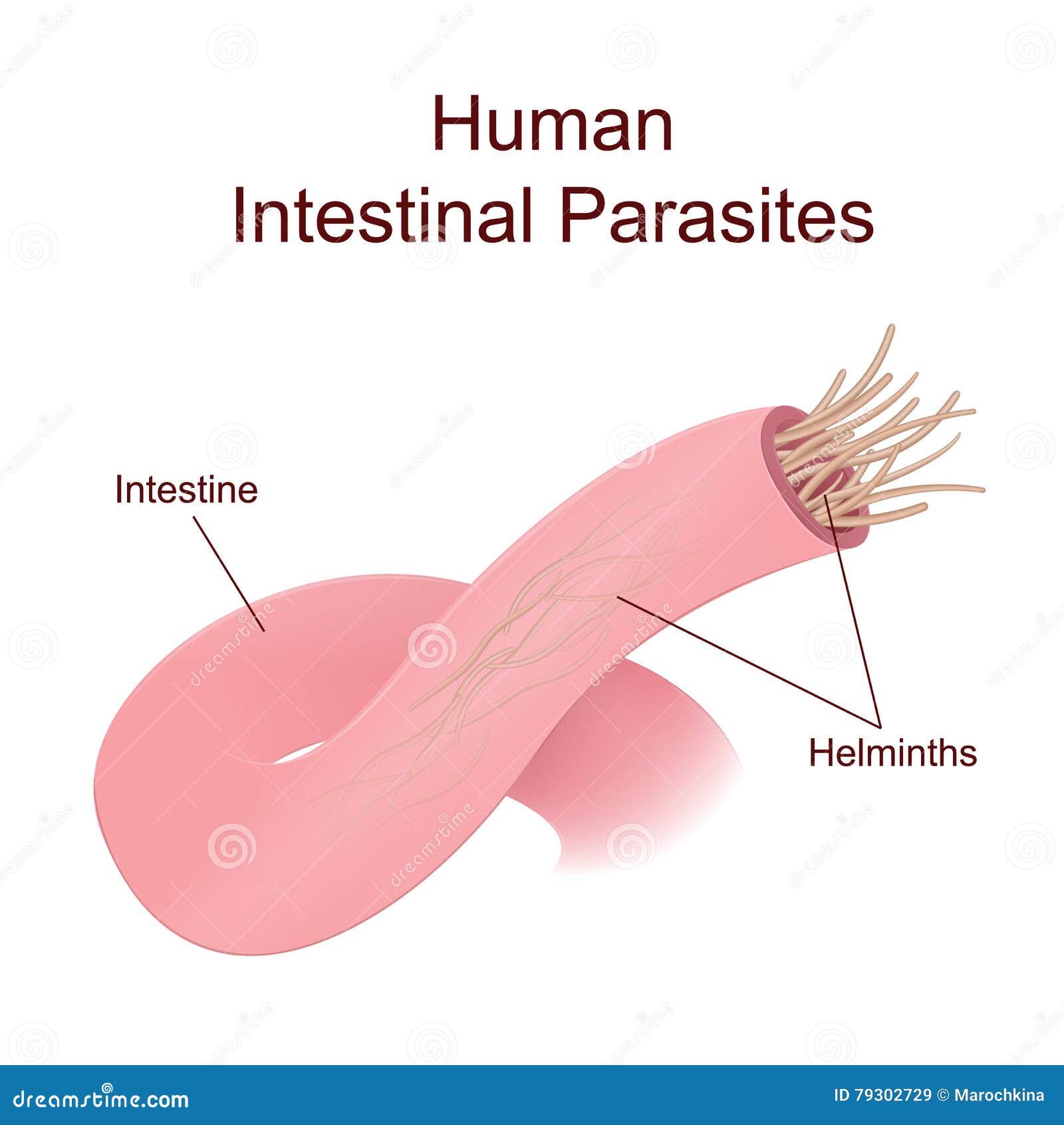 Illustratie Van Interne Menselijke Parasieten Vector Illustratie ...