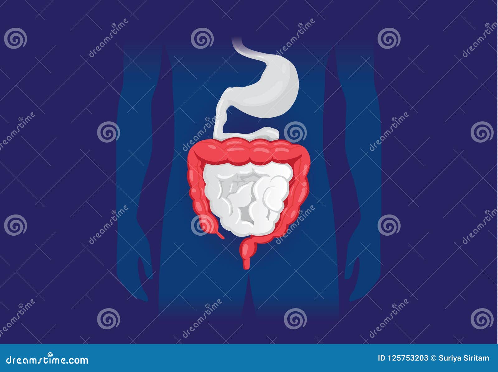 Illustration about Abnormal Symptom of Human Large Intestine. Stock ...