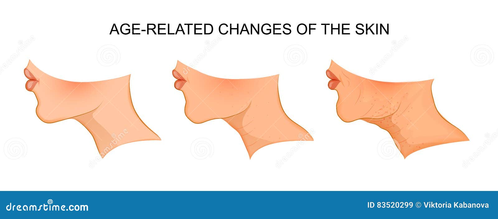 Illustration of Age-related Skin Changes. Aging Stock Vector ... Illustration of Age-related Skin Changes. Aging Stock Vector ...