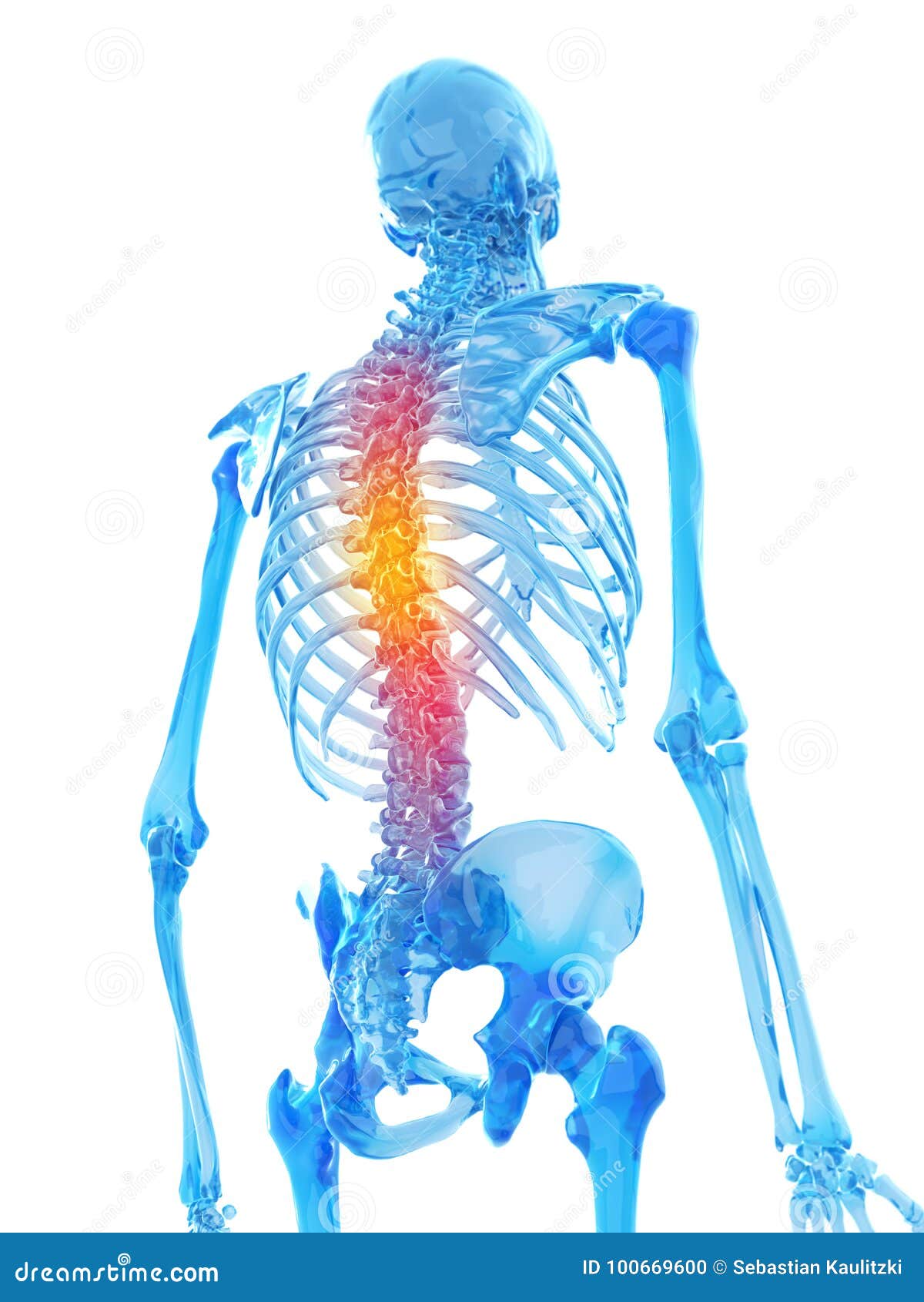 Illustration of backache stock illustration. Illustration of inflamed ...
