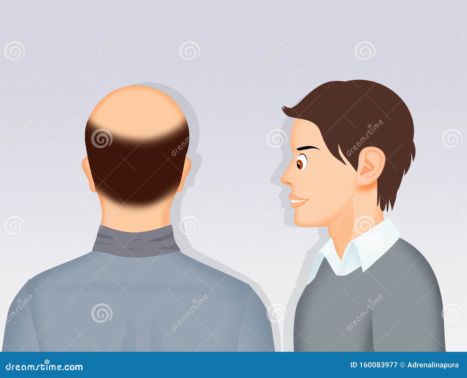 Illustration of baldness stock illustration. Illustration of alopecia ...