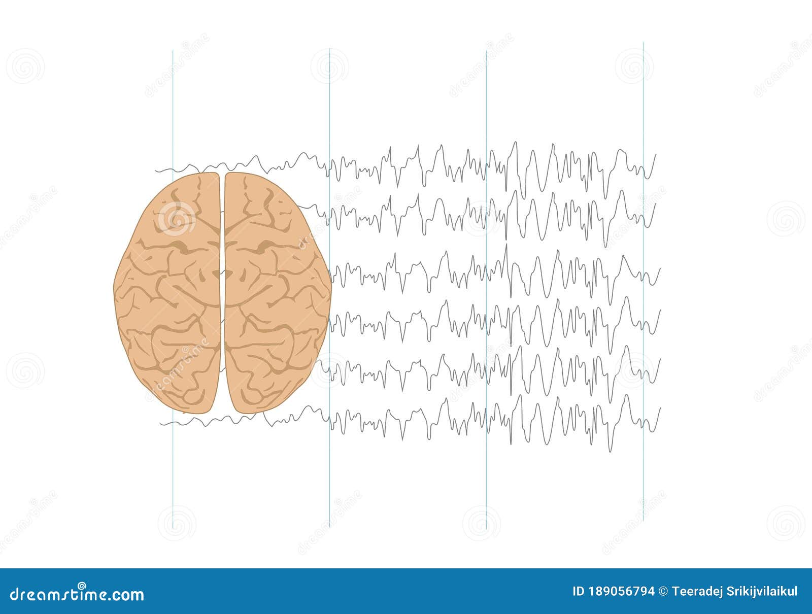 Illustration of Brain and Abnormal Brain Waves Stock Vector ...